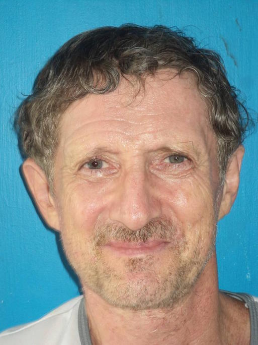 Ron - Action International Ministries